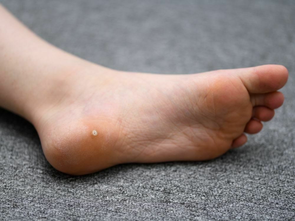 Mon Podiatre – Clinique Podiatrique de l’Avenir à Laval